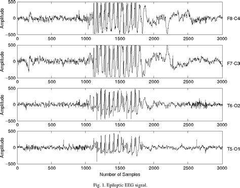 Figure 1 From Wavelet Neural Network Classification Of Eeg Signals By