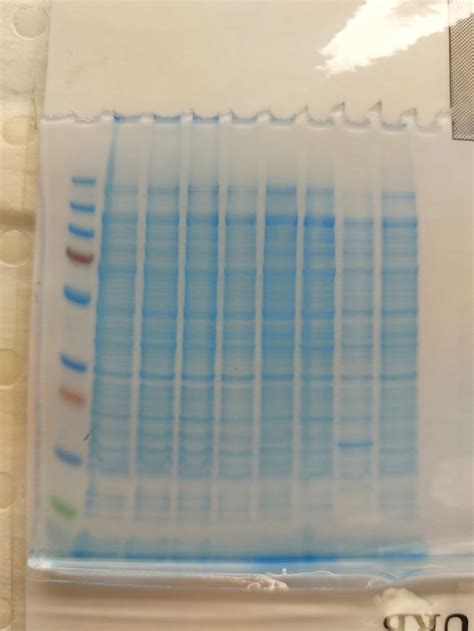 No Sign Of Protein Expression From Whole Cell Lysate Sds Page Researchgate