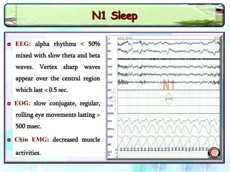 Polysomnogram Interpretetion Pptx