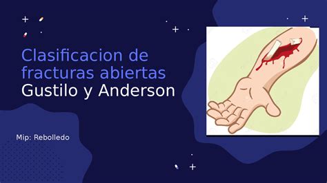 Fracturas Expuestas De Gustilo Y Anderson Diapositivas De