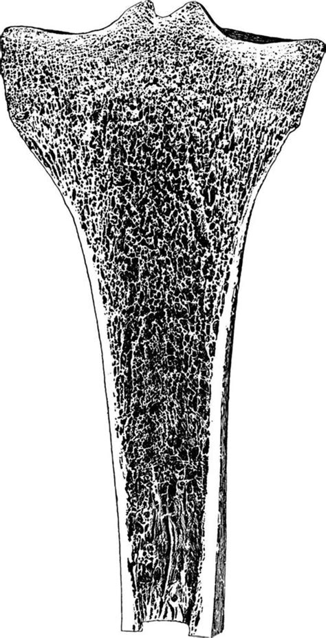 Frontal Section Of Upper End Of Tibia Vintage Illustration 13782341