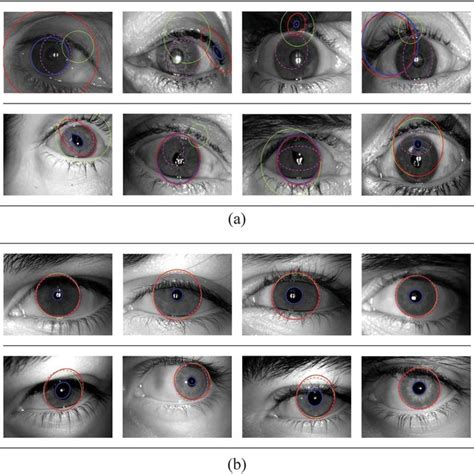 Illustrating Healthy Iris Images And Cataract Affected Iris Images From Download Scientific