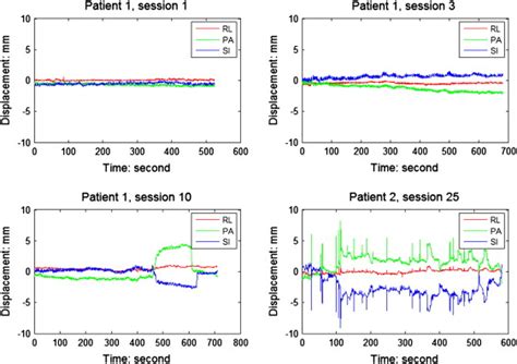 Dosimetric Consequences Of Intrafraction Prostate Motion International Journal Of Radiation