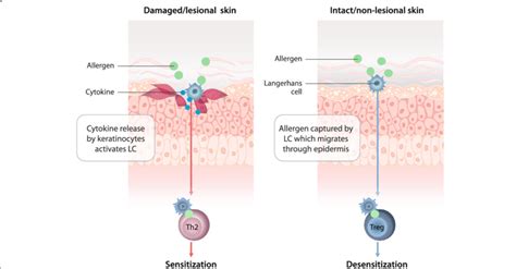 Langerhans Cells Location