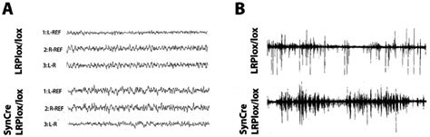 Electroencephalography And Electromyography A EEG Download Scientific Diagram