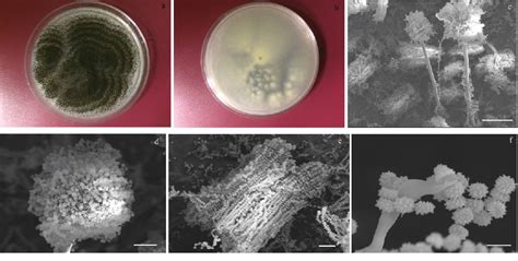 Table 1 From Confrontation Of Trichoderma Asperellum Vsl 80 Against