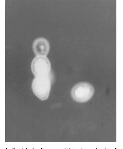 Cryptococcus Diffluens Semantic Scholar