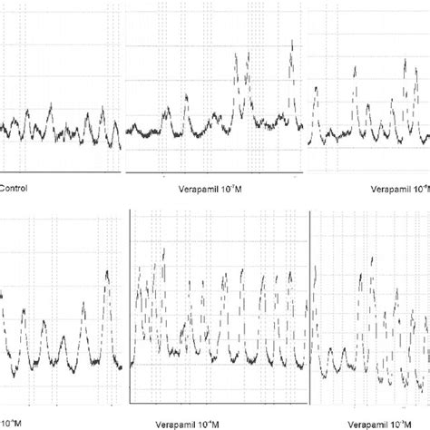 Time Dependent Control Recording Of The Spontaneous Muscular Activ­ Ity