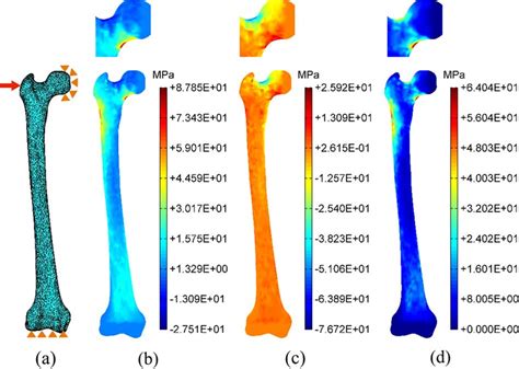 Boundary Condition And Stress Distribution Of Sideways Fall