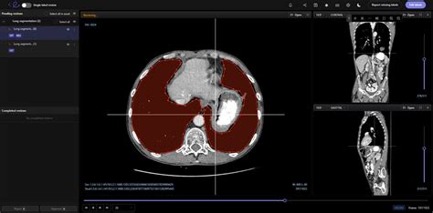 How To Structure Qa Workflows For Medical Images Encord