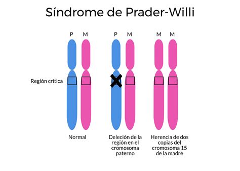 Síndrome De Prader Willi Síntomas Tratamiento Y Cura Terapia Gratis