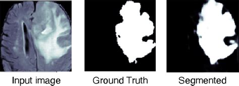 Figure From Implementation Of A Modified U Net For Medical Image Segmentation On Edge Devices