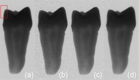 X Ray Images Obtained From Various Configurations Of Detectors For An Download Scientific