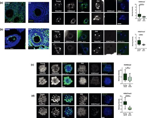Heterochromatin Loss Appear Uniformly In Diverse Oocytes Populations