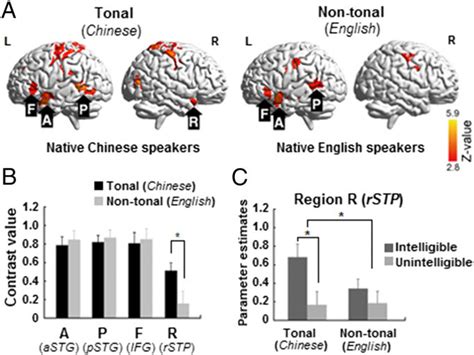 Brain Activations During The Processing Of Intelligible Speech A