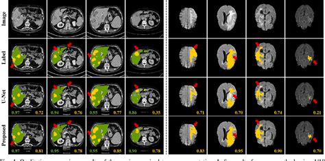Figure 4 From Mumfordshah Loss Functional For Image Segmentation With Deep Learning Semantic