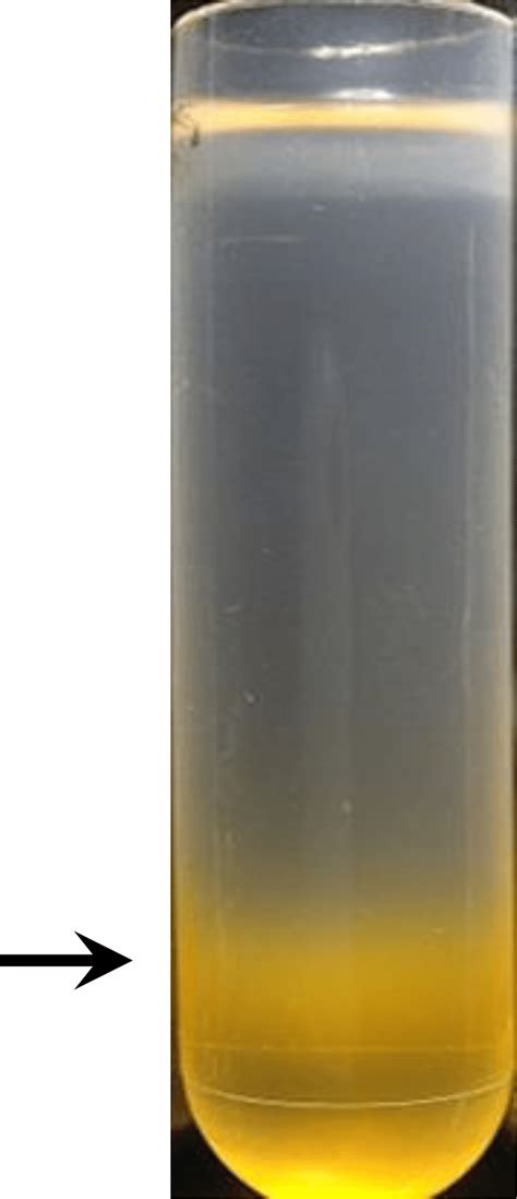 Cscl Density Gradient Ultracentrifugation Of The S13evs Band Arrow Download Scientific