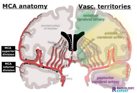 Interventional Radiology The Stroke Patient