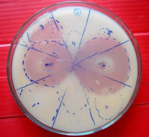 Liquid Phosphate Solubilizing Bacteria Packaging Type Bottle 1 Litre