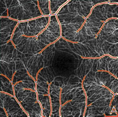 Analayzeskeleton Count And Mark Branch Points Image Analysis Image