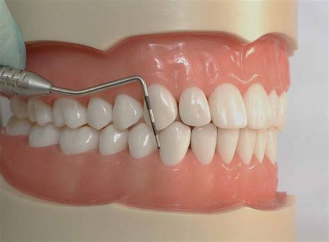 Implantología Clínica Dental Mayo