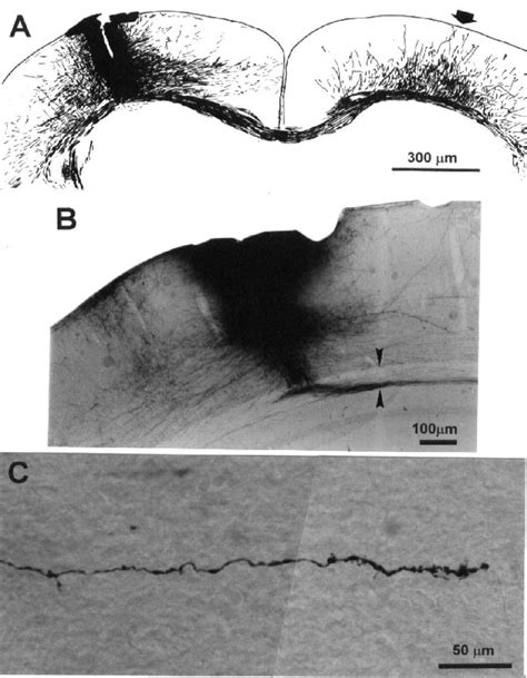 A Camera Lucida Drawing Of A Biocytin Injection Site In The Parietal Download Scientific