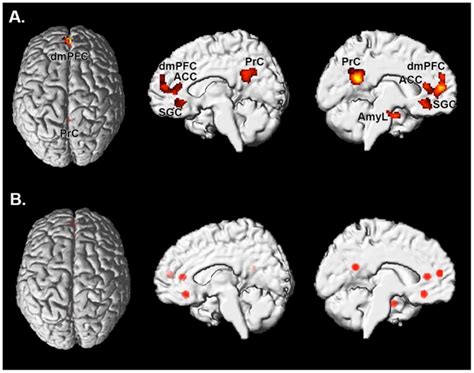 Acc Anterior Cingulate Cortex Amyl Left Amygdala Dmpfc Dorsomedial Download Scientific