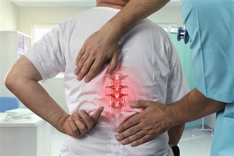 Facet Joint Nerve Ablation Coastal Health