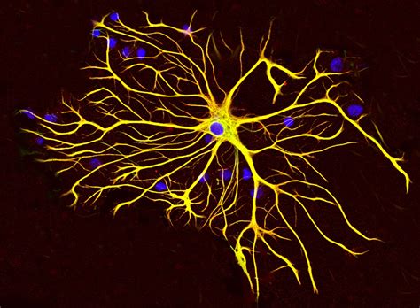 Astrocyte Wikipedia