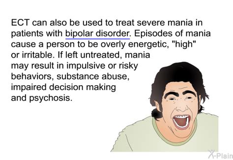 Electroconvulsive Therapy Ect