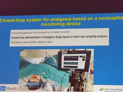 Ignacio Gonzalez Campos On Linkedin Esaic24 Closeloop Remifentanyl