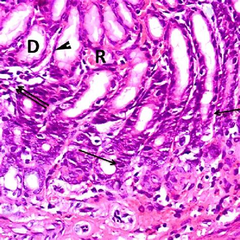 A Photomicrograph Of A Section In Rats Fundic Mucosa Of Download