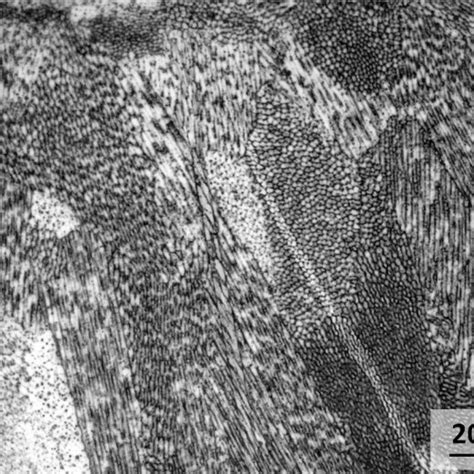 Microstructure Of The Layer Remelted Using Gtaw Method A Central