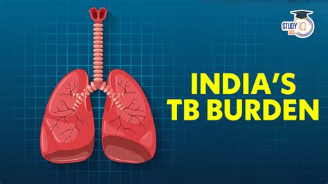 Indias Tb Burden