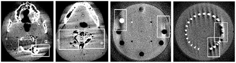 Rois Indicated By Rectangles Within Transverse Slices At 337 Cm Download Scientific Diagram