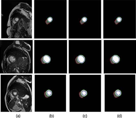 Pdf Mamba Unet Unet Like Pure Visual Mamba For Medical Image Segmentation Semantic Scholar