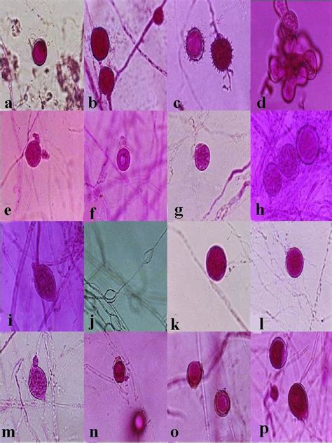 Sexual And Asexual Organs Of Pythium Species Isolated In Fars Province Download Scientific Sexual And Asexual Organs Of Pythium Species Isolated In Fars Province Download Scientific