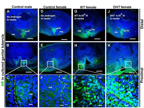 Distribution Of Androgen Receptors Ars In Cultured Mouse Genital