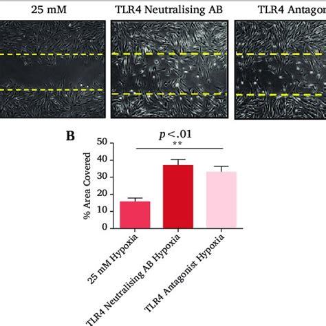 Scratch Migration Assay Comparing Fibroblast Migration In Vhg Hypoxic Download Scientific
