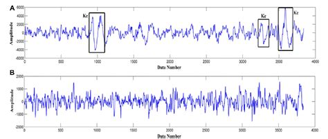 Figure 1 From Detection Of Eeg K Complexes Using Fractal Dimension Of