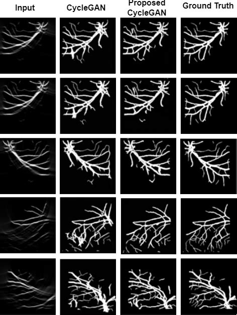 Unsupervised Photoacoustic Tomography Image Reconstruction From Limited View Unpaired Data Using