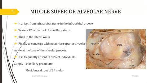 Maxillary Nerve Pptx