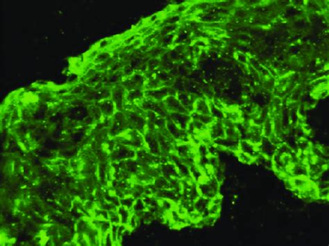 Direct Immunofluorescence Of Oral Epithelium Showing Characteristic Download Scientific Diagram
