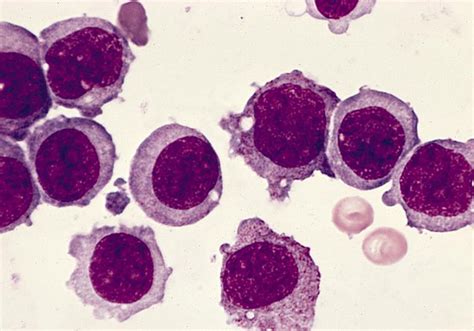 Pathology Outlines M5a