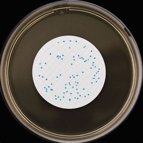 Reference Material For Compass Enterococcus Agar • Biosistostandard