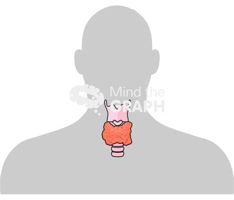 Hyperthyroidism Body