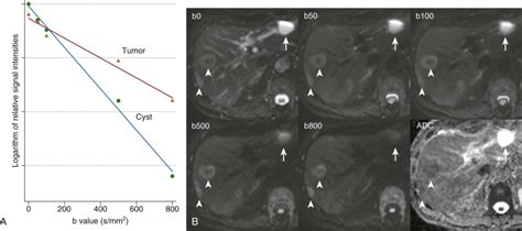 Diffusion Weighted Imaging Of The Abdomen Radiology Key