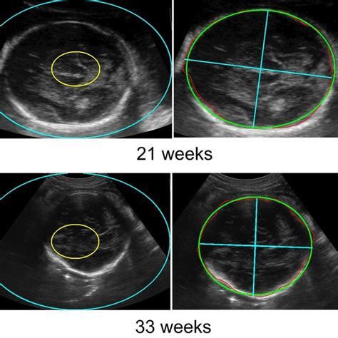 Segmentation Results Left Column Automated Initialization Foreground Download Scientific