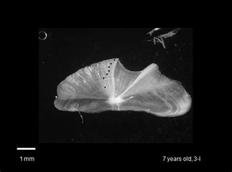 Transverse Section Of Processed And Aged Otolith Of A Year 7 Spotcheek Download Scientific