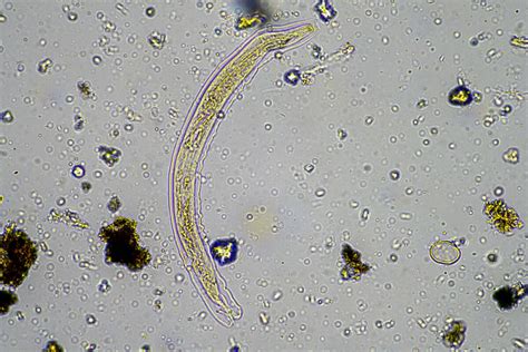 Plant Virus Recruited To Save Crops From Root Eating Nematodes Plant Virus Recruited To Save Crops From Root Eating Nematodes